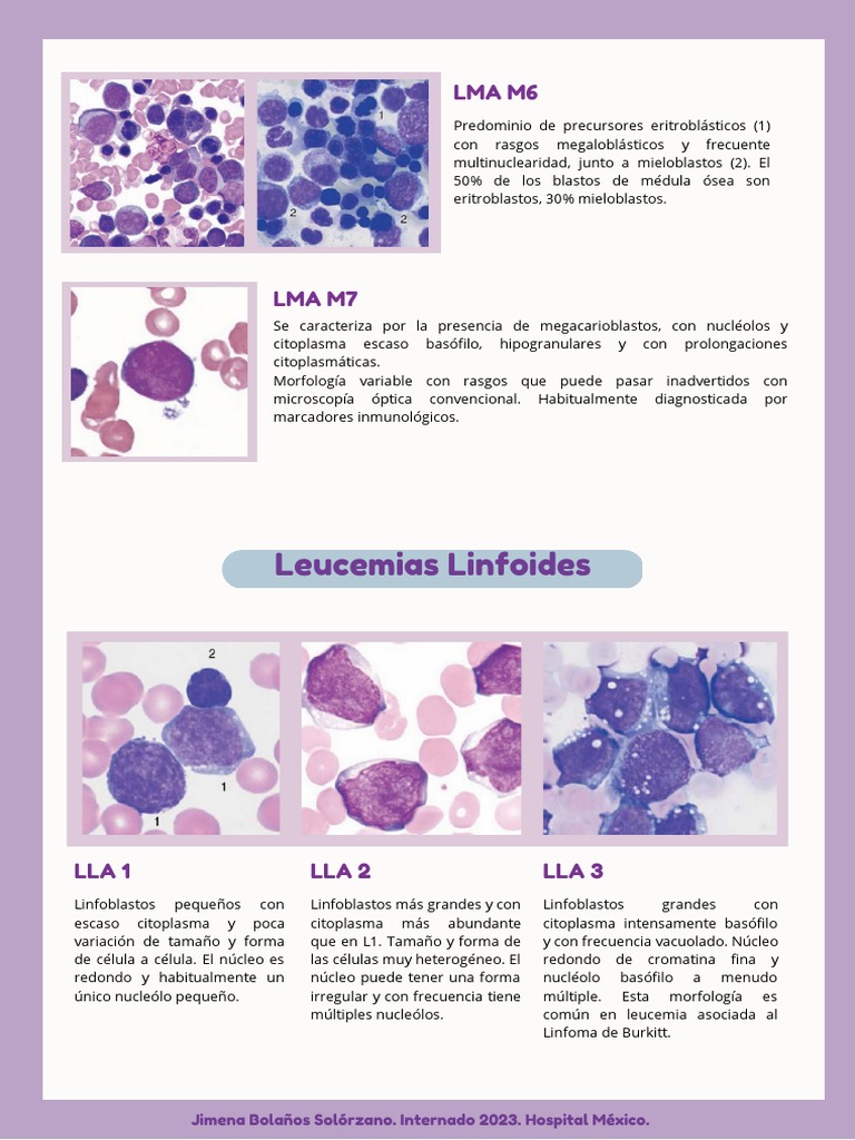 Blastos Leucemias Agudas Lamina | PDF | Leucemia | Nucleo celular