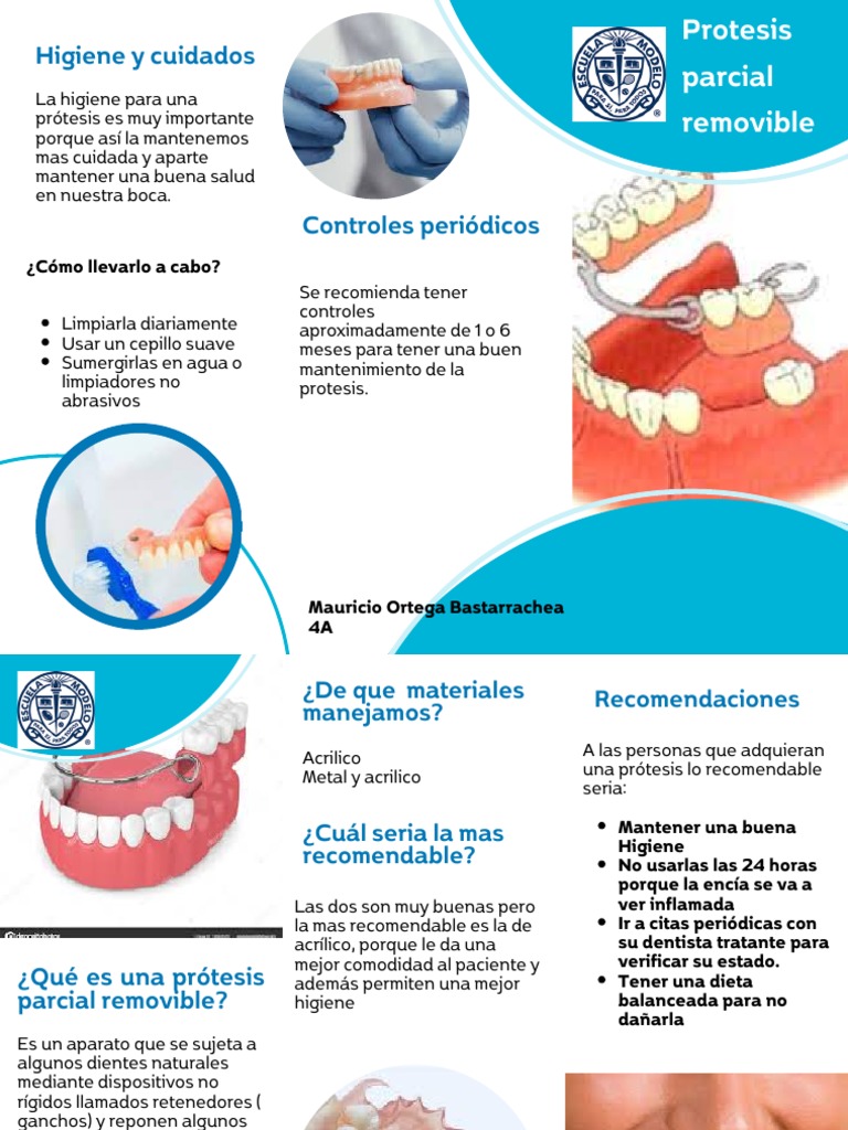 Protesis Parcial Removible | PDF