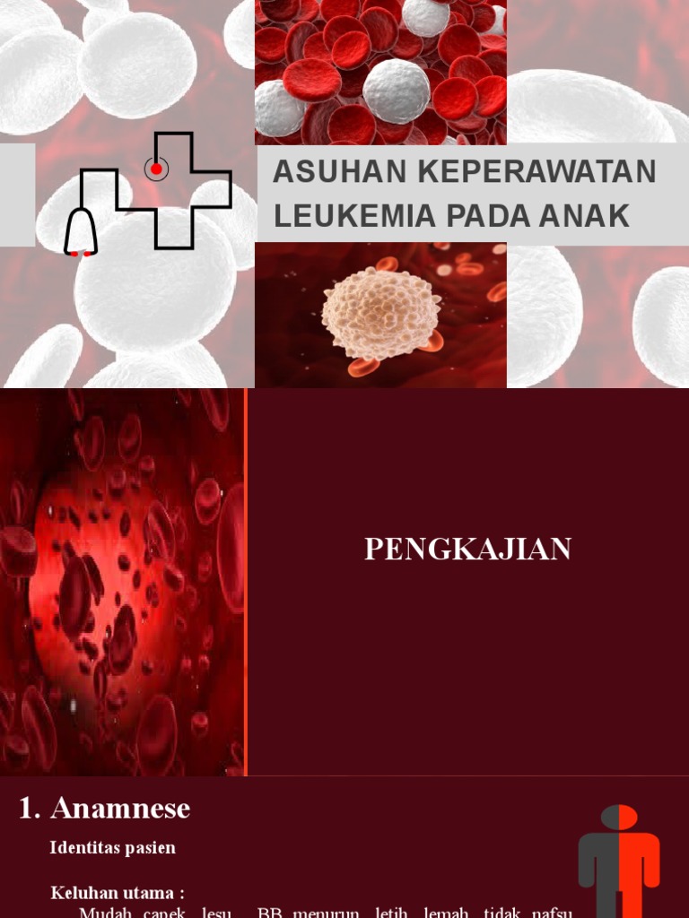 Askep Leukemia Pada Anak | PDF