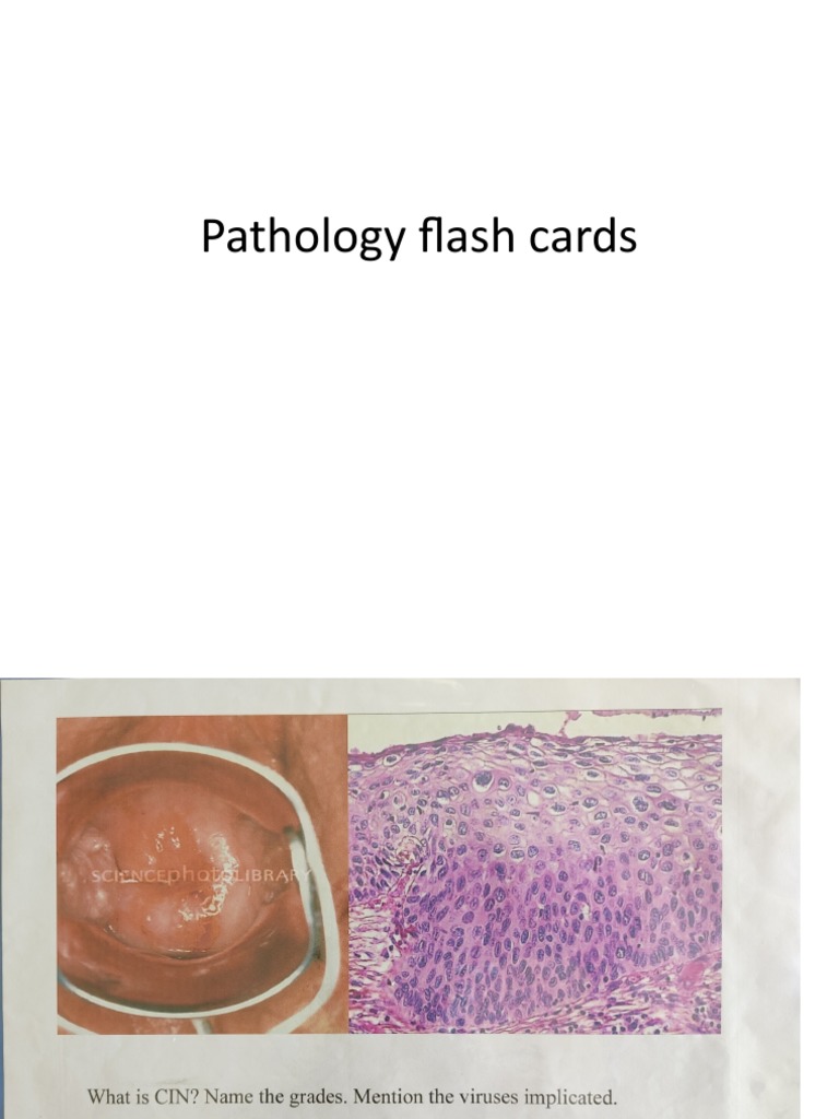 Flash Cards PATHOLOGY | PDF