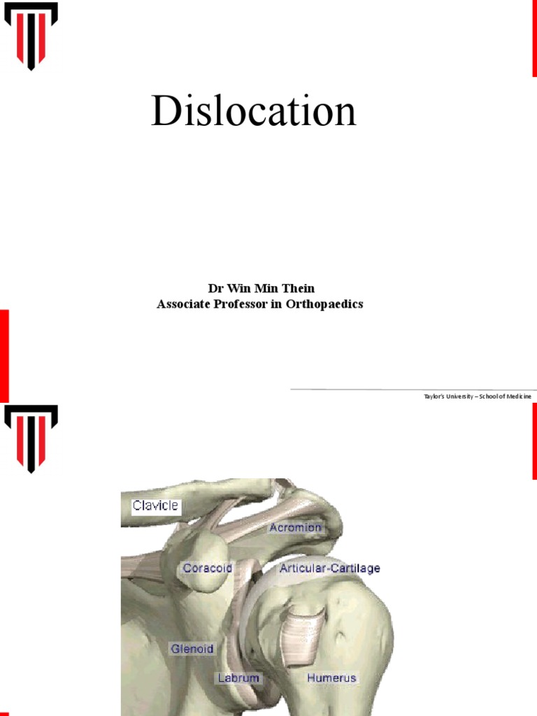 Integrated Session - Dislocation | PDF | Hip | Shoulder