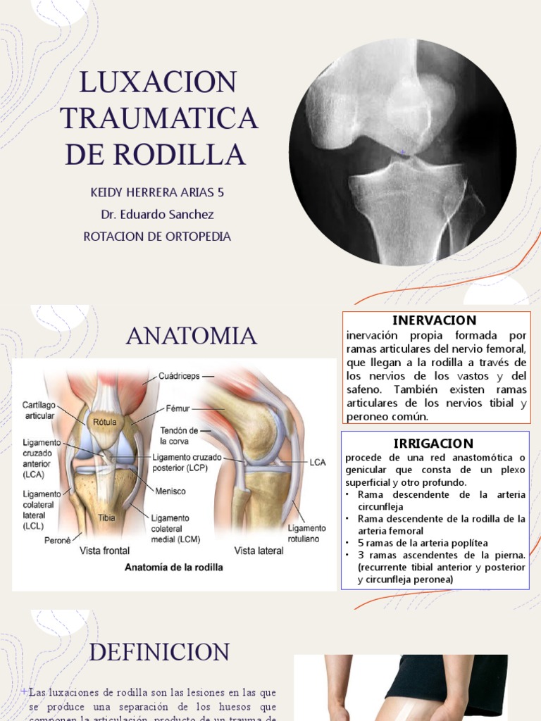 LUXACION DE RODILLA | PDF | Rodilla | Medicina CLINICA