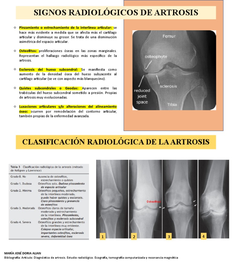 SIGNOS RADIOLÓGICOS DE ARTROSIS | PDF