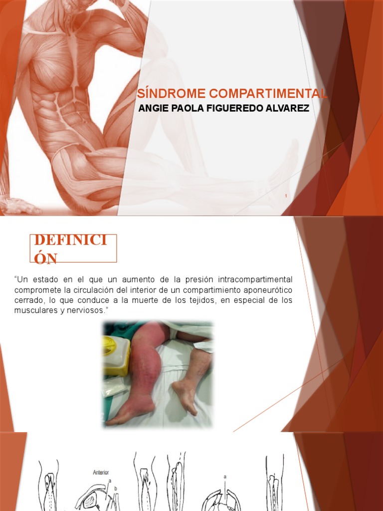 Síndrome Compartimental #3 | PDF | Enfermedades y trastornos humanos ...