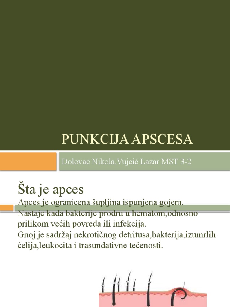 Punkcija Apcesa | PDF