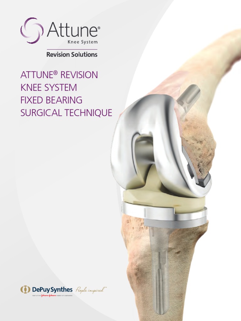 Attune FB Revision Surgical Technique | PDF | Knee | Musculoskeletal System