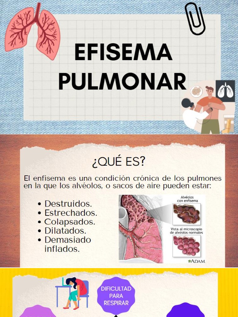 Efisema Pulmonar | PDF