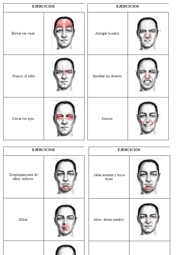 Paralisis de Bell | PDF