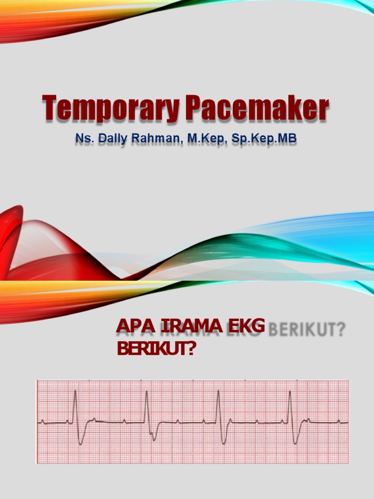Temporary Pacemaker Guide | PDF