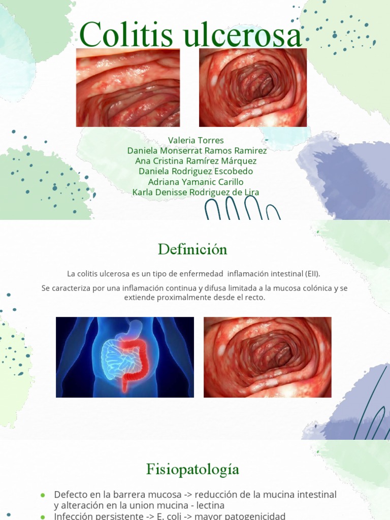 Colitis Ulcerosa: Diagnóstico y Tratamiento | PDF | Cáncer colonrectal ...