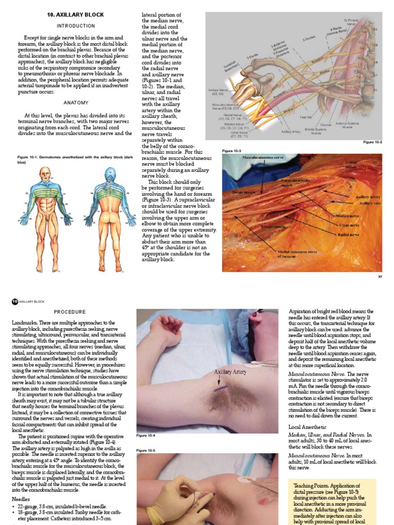 Chapt 10 | PDF | Arm | Human Anatomy