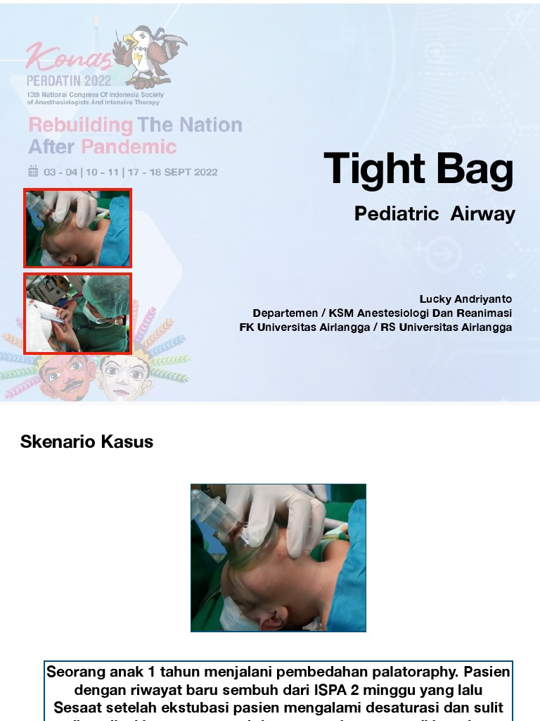 Pediatric Airway | PDF