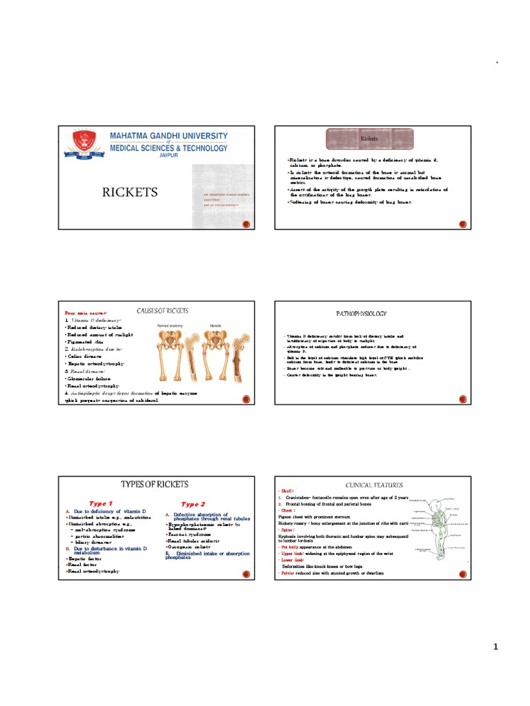 Rickets | Download Free PDF | Vitamin D | Bone