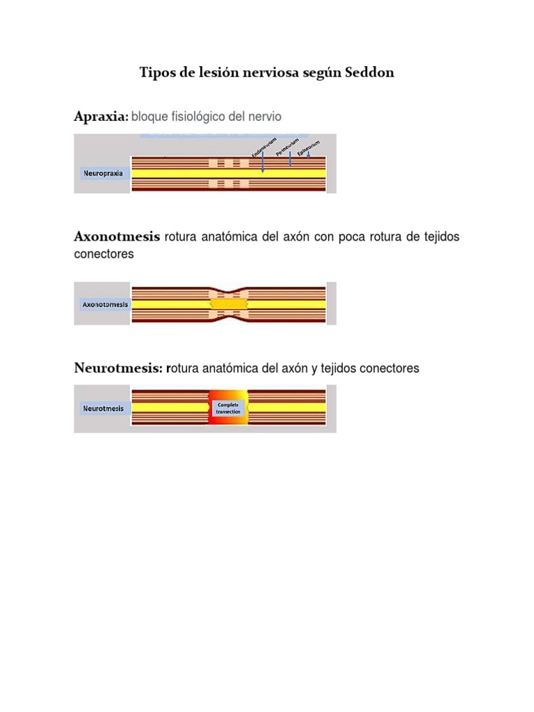 Tipos de Lesión Nerviosa Según Seddon | PDF