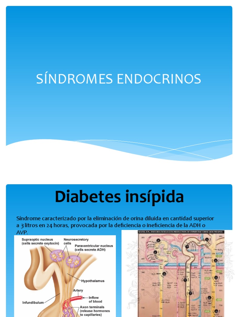 S Ndromes Endocrinos | PDF | Hormona estimulante de la tiroides | Tiroides