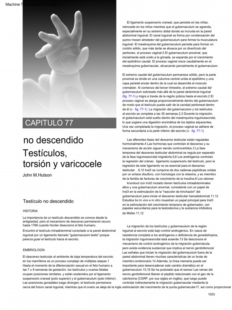 Torsion Varicocele 2 Pdf Testículo Gonadotropina Coriónica Humana