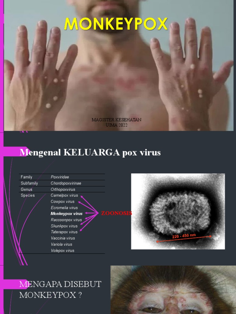 Panduan Lengkap tentang Monkeypox | PDF