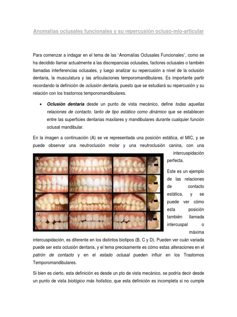 Anomalías Oclusales Funcionales - Primera Parte | PDF | Estrés ...