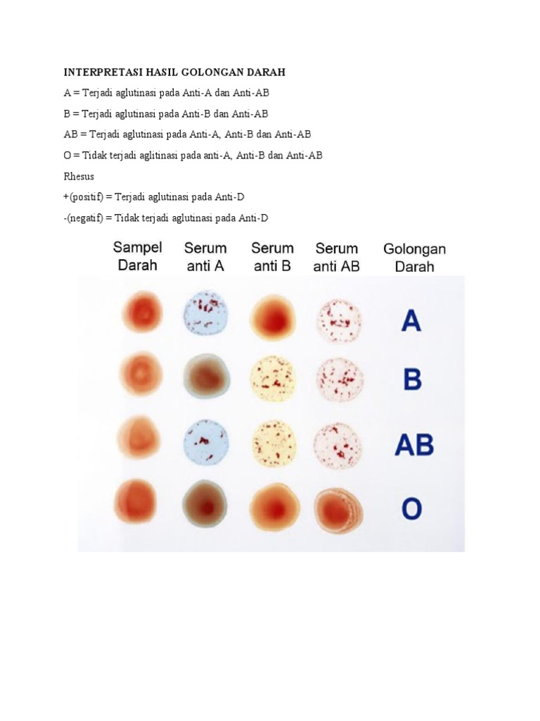 Interpretasi Hasil Golongan Darah | PDF