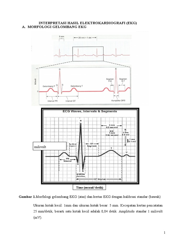 MORFOLOGI DAN INTERPRETASI EKG | PDF