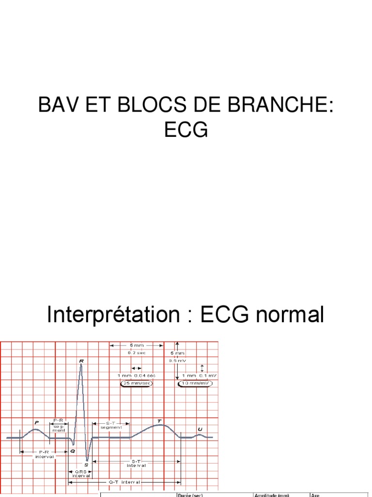 Bav BBD | PDF | Électrocardiographie | Cœur