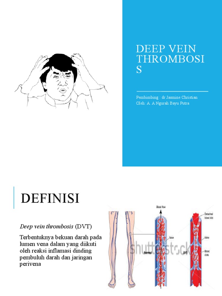 Panduan Lengkap Deep Vein Thrombosis | PDF | Sains & Matematika