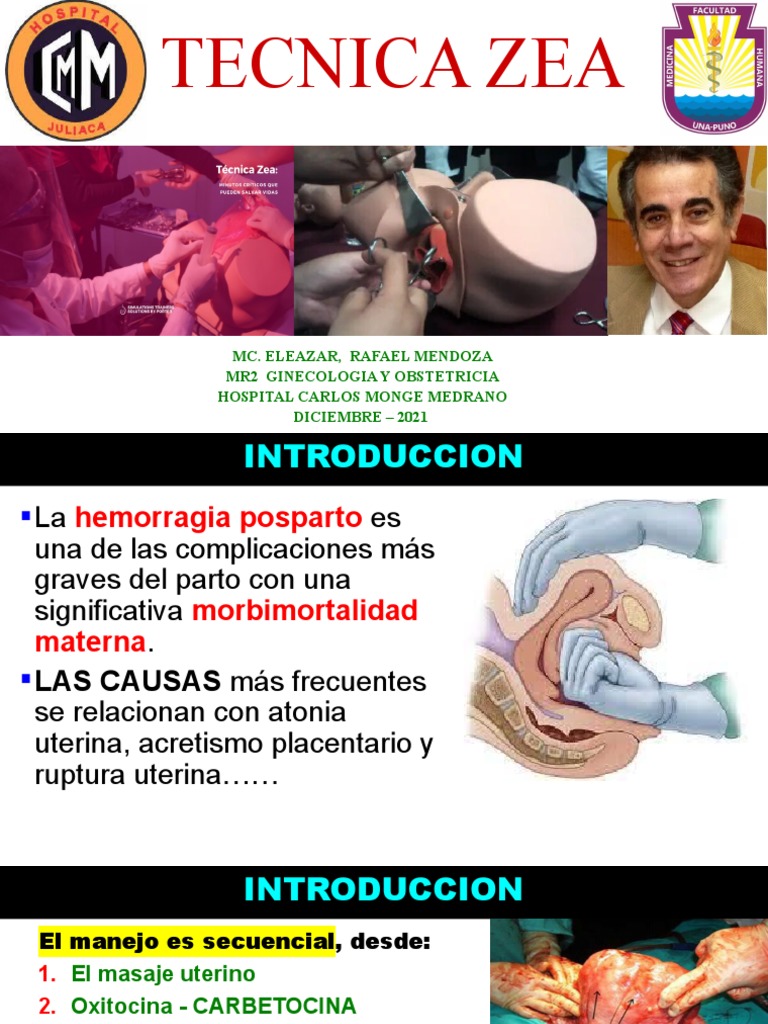 Técnica ZEA para Hemorragia Posparto | PDF | Cuidado de la salud | Embarazo humano