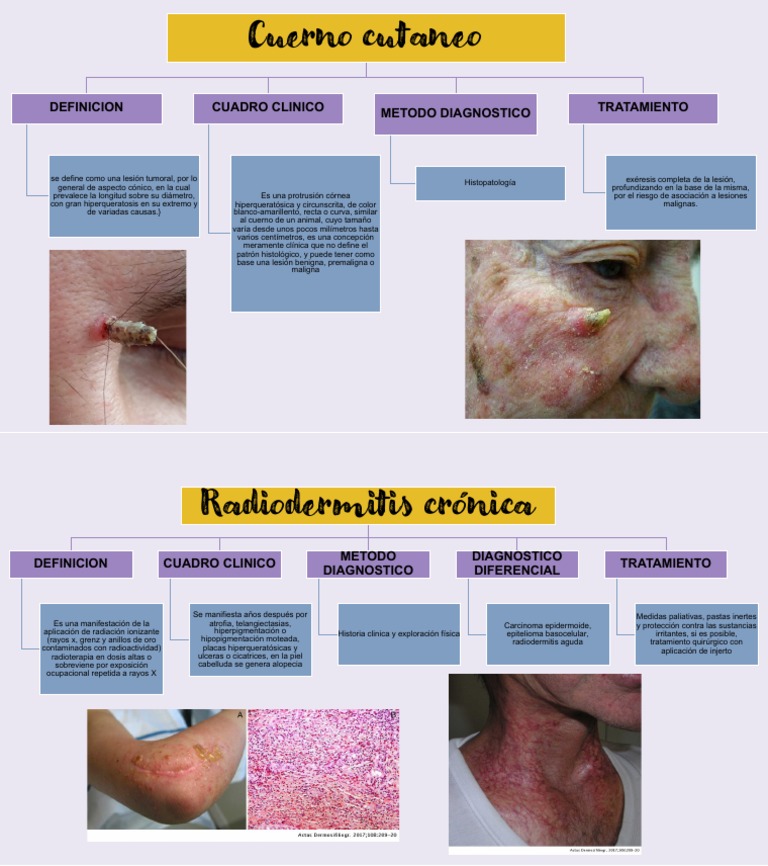 Cuerno Cutaneo Radiodermitis Cronica | PDF | Medicina CLINICA ...