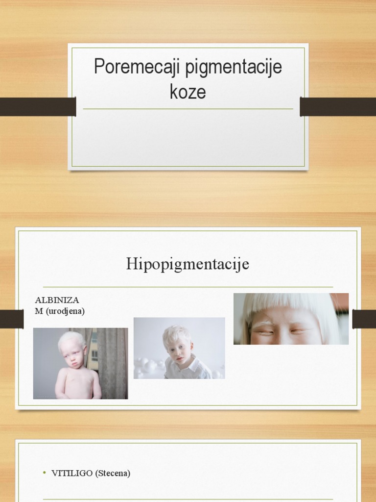Poremecaji Pigmentacije Koze DEJA | PDF