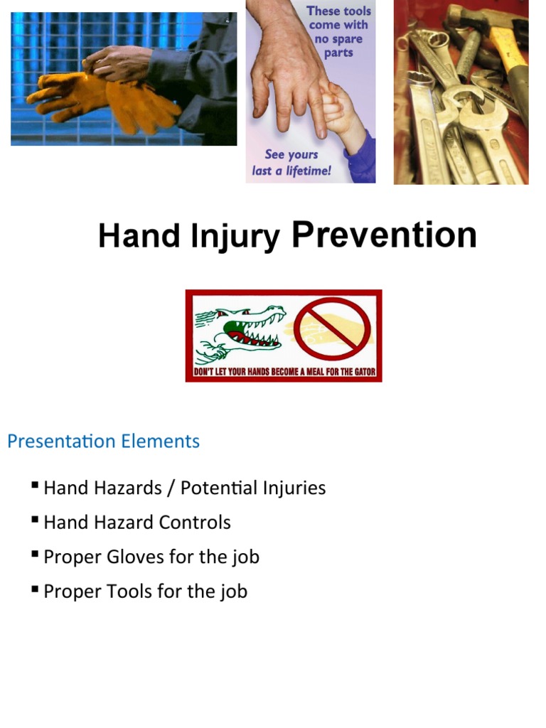 Hand Injury Prevention | PDF | Hand | Injury
