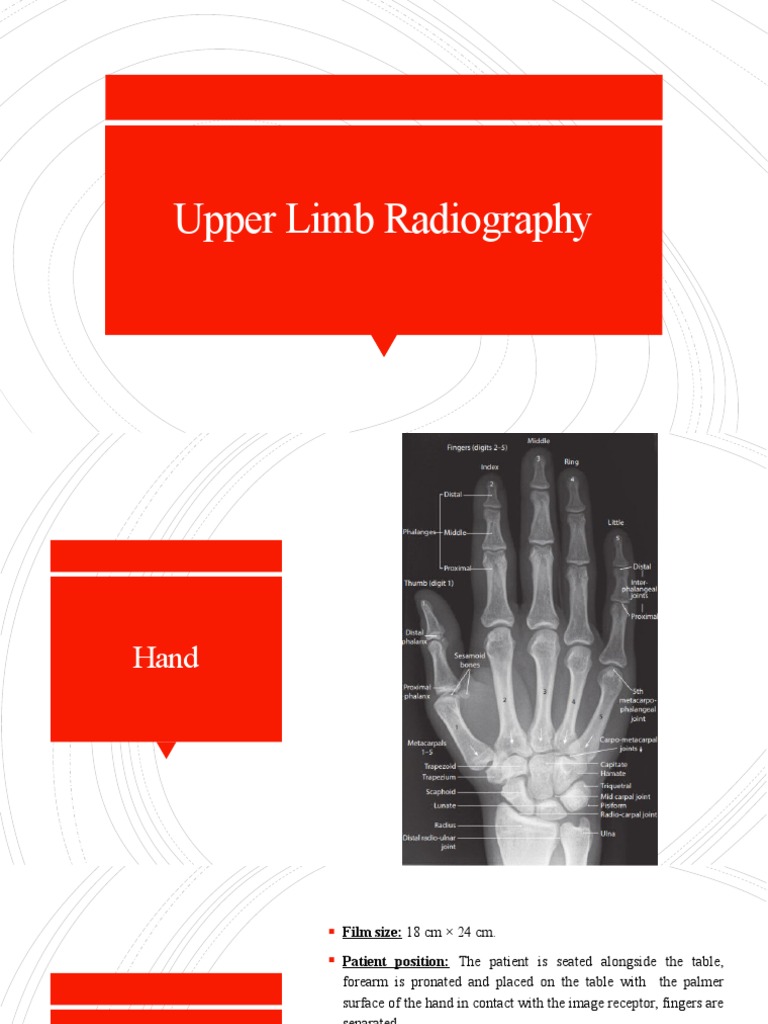 Upper Limb Radiography Download Free Pdf Elbow Anatomical Terms