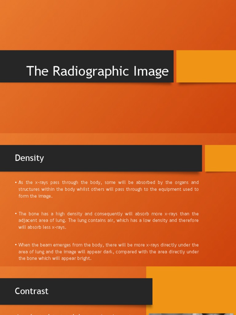 Understanding Radiographic Image Quality | PDF | X Ray | Radiography