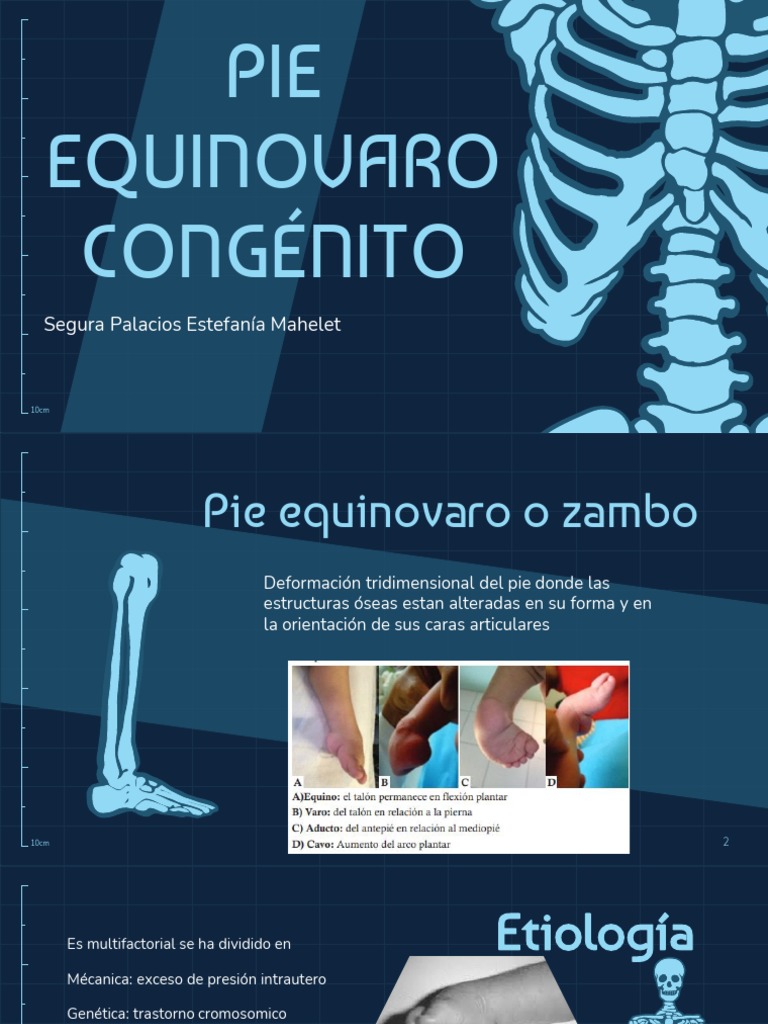 Pie Equinovaro Congénito: Causas y Tratamiento | PDF | Pie | Sistema ...