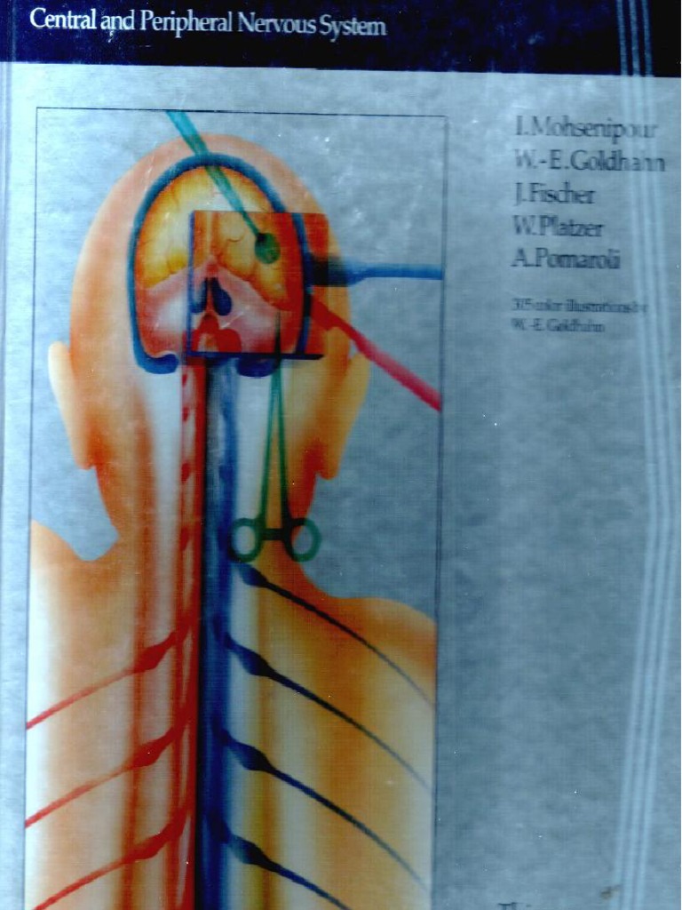 Neurosurgical Approaches Overview | PDF | Vertebral Column | Surgery