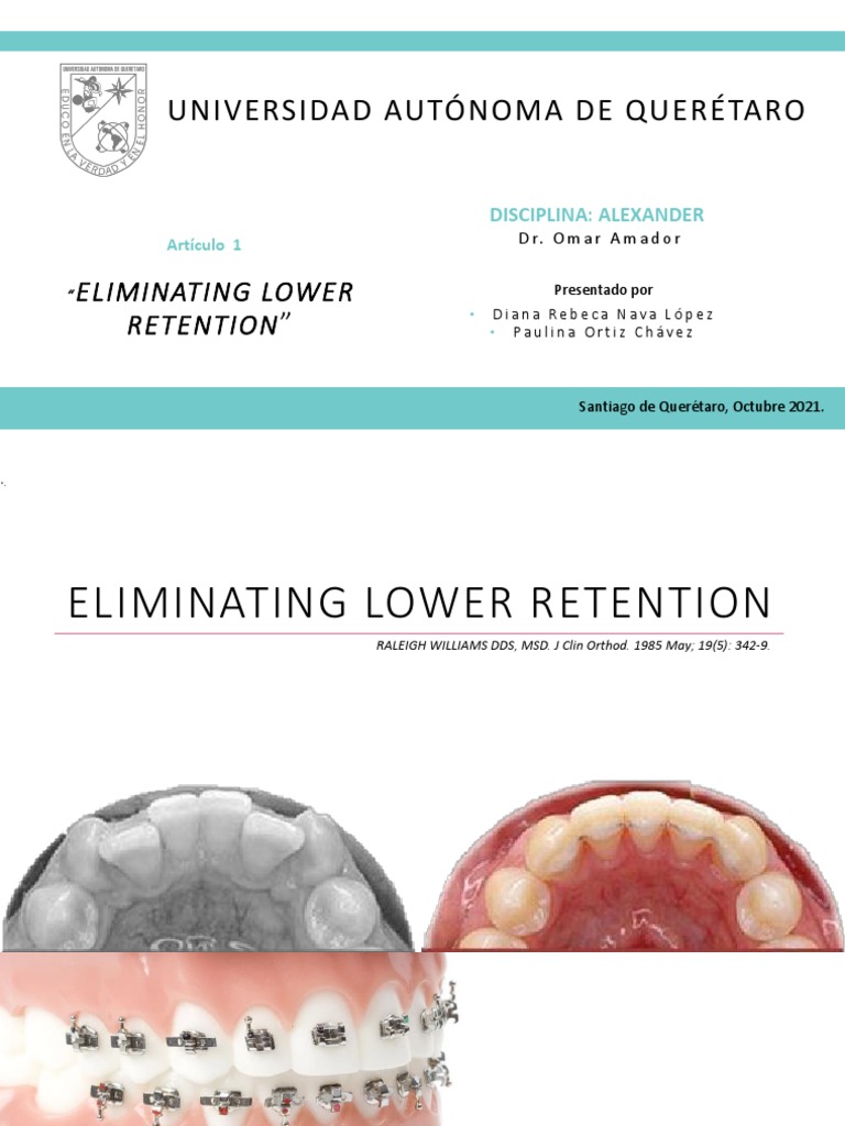 Eliminating lower retention | PDF | Ramas de Odontología
