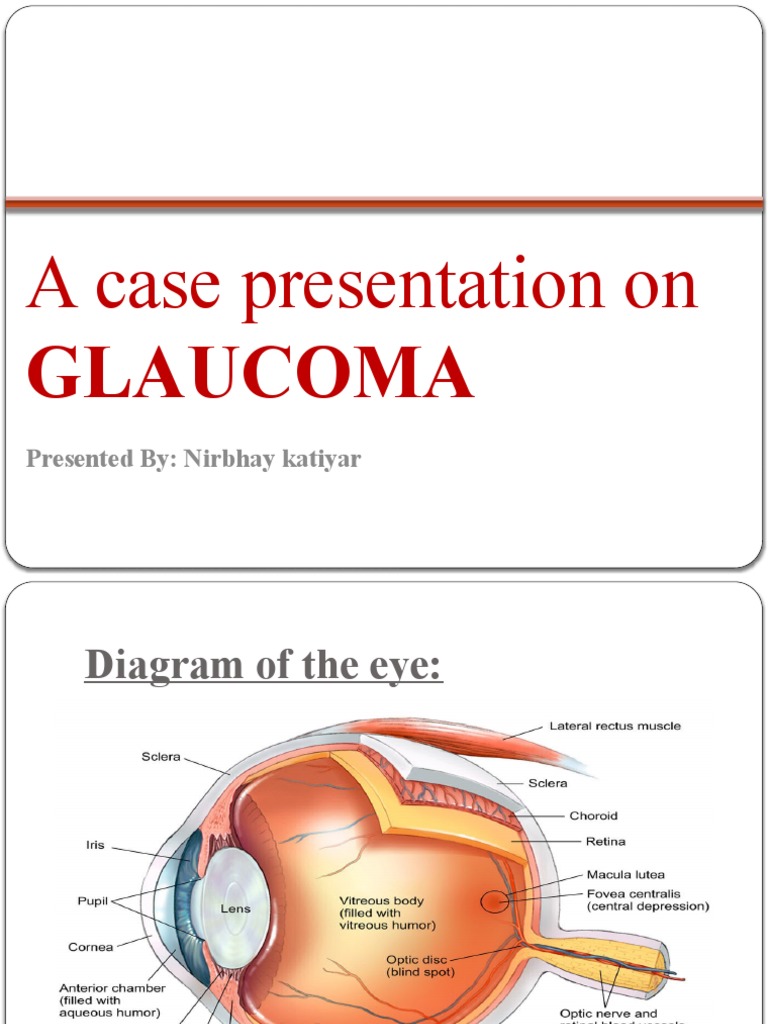 A Case Presentation On GLAUCOMA. | PDF | Glaucoma | Human Eye