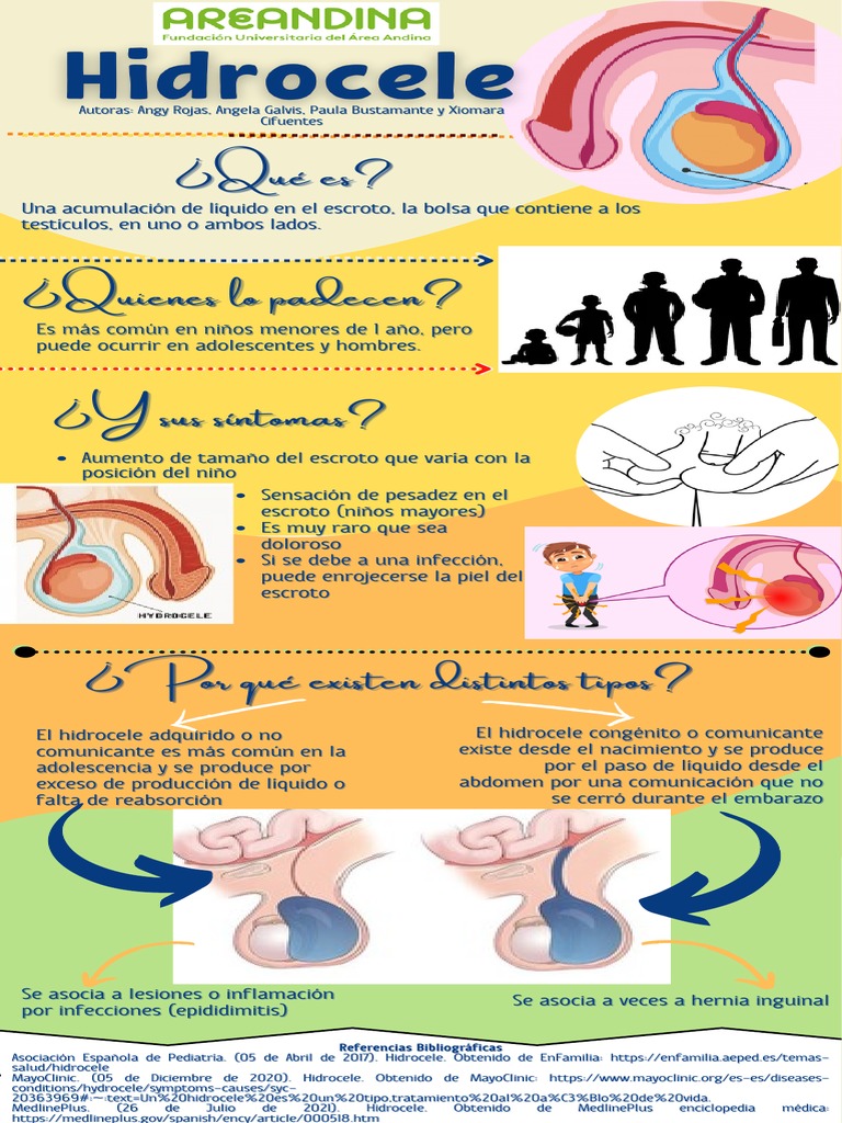 Infografía Hidrocele Grupo 7 | PDF