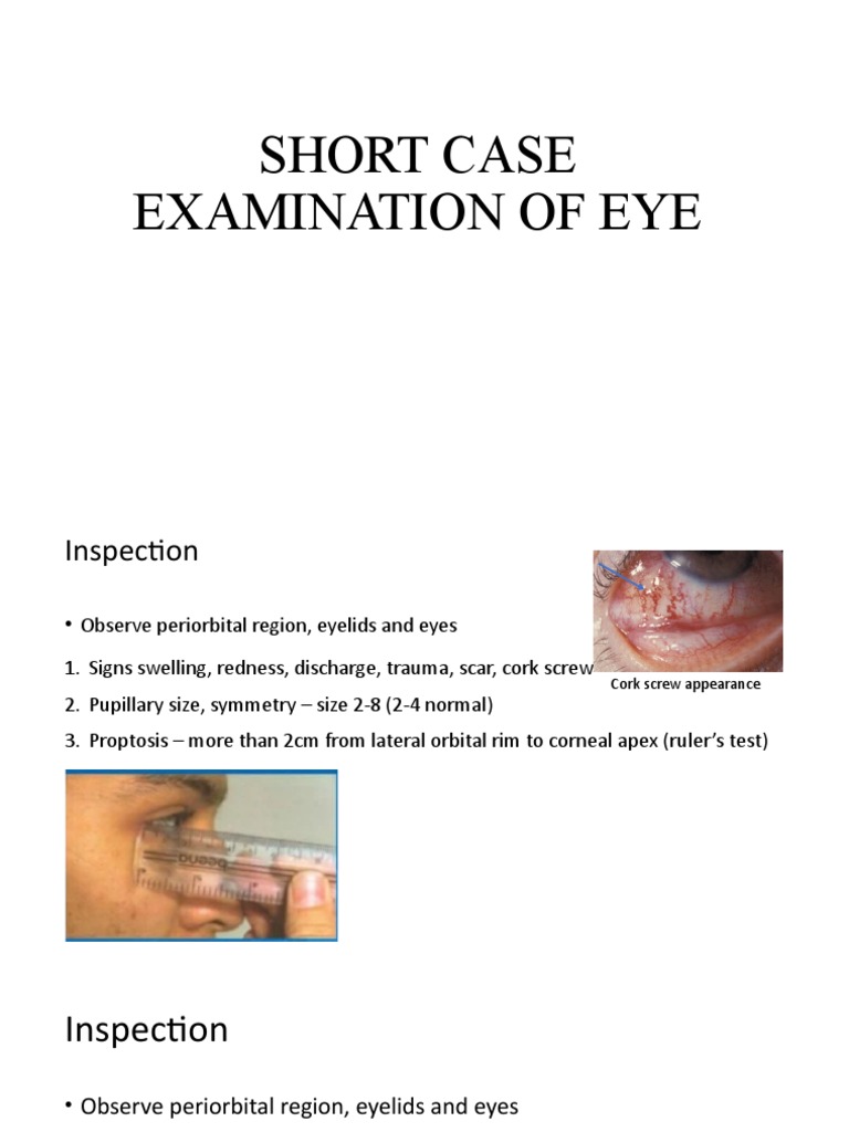 Comprehensive Eye Exam Guide | PDF | Light | Neuroscience