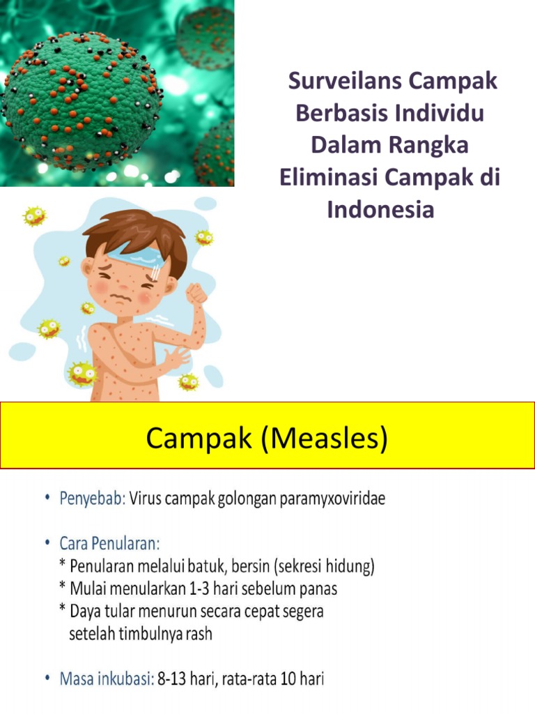 Surveilans Campak 01 | PDF