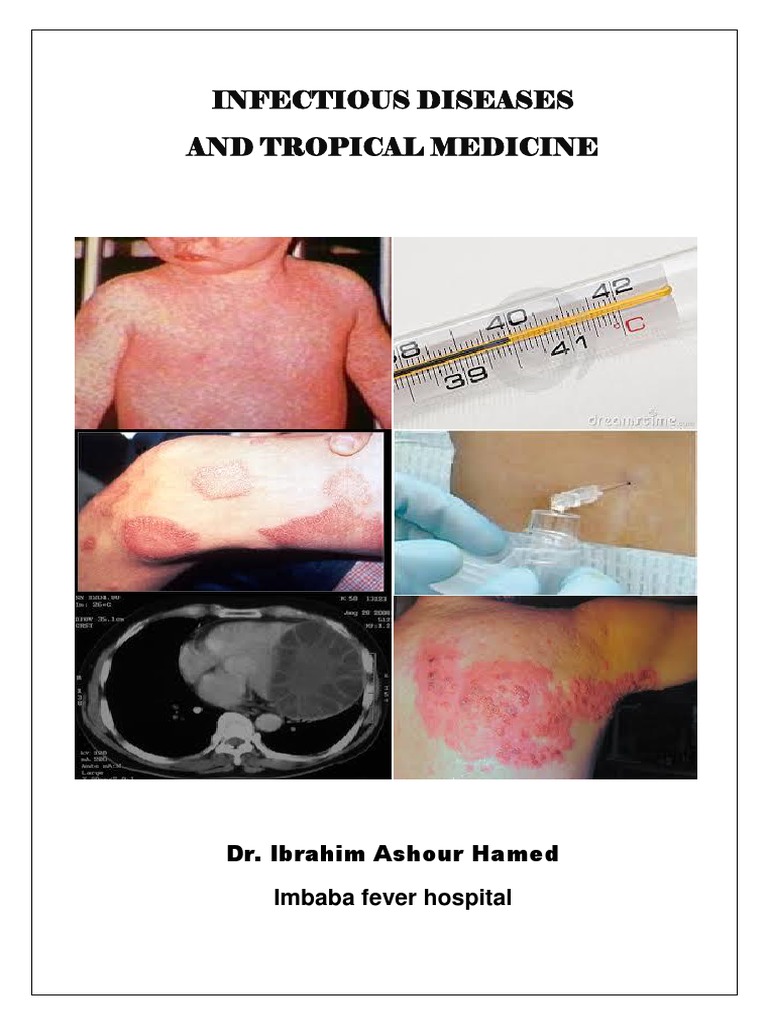 Summary of Infectious Diseases | PDF | Meningitis | Cerebrospinal Fluid
