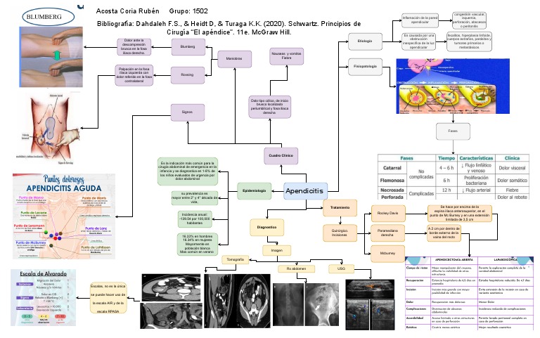 Apendicitis Mapa Mental | PDF | Dolor | Síntomas y signos