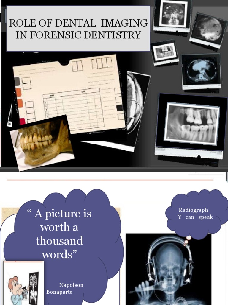 Imaging in Forensic Dentistry | PDF | Dentistry | Stereoscopy