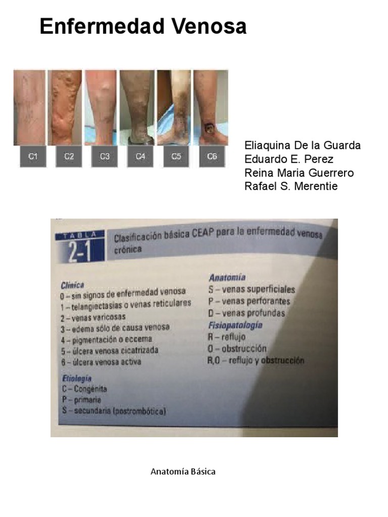 Enfermedad Venosa. | PDF | Embolia | Trombo