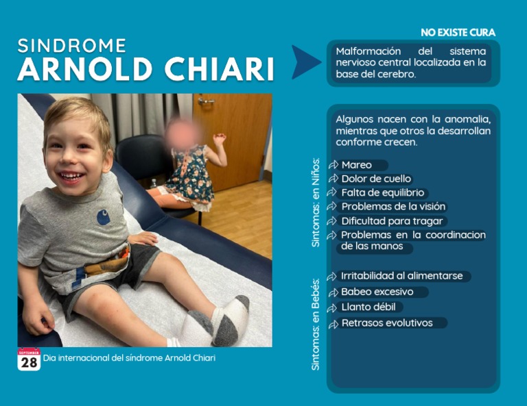 Síntomas del Síndrome Arnold Chiari | PDF