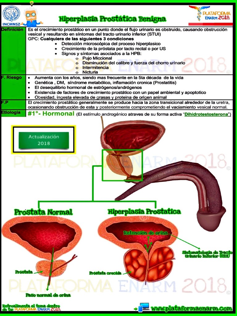 Uro Flash Cards | PDF