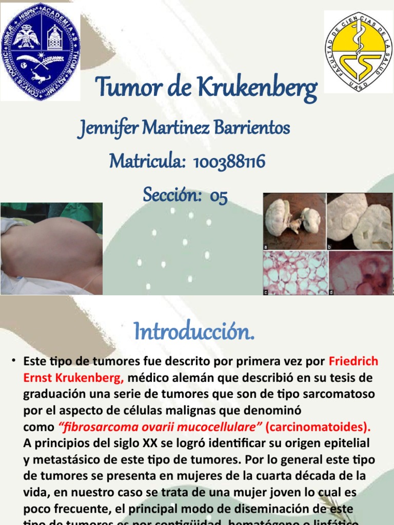 Tumor de Krukenberg | PDF | Cáncer colonrectal | Medicina CLINICA