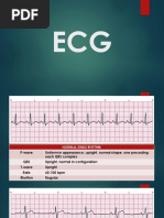EKG Flash Cards | PDF | Cardiac Arrhythmia | Cardiovascular System