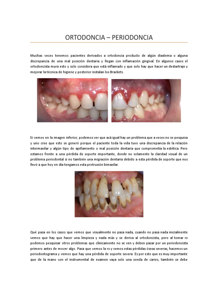 Clase 12 Ortodoncia - Periodoncia | PDF | Ortodoncia | Ramas de Odontología
