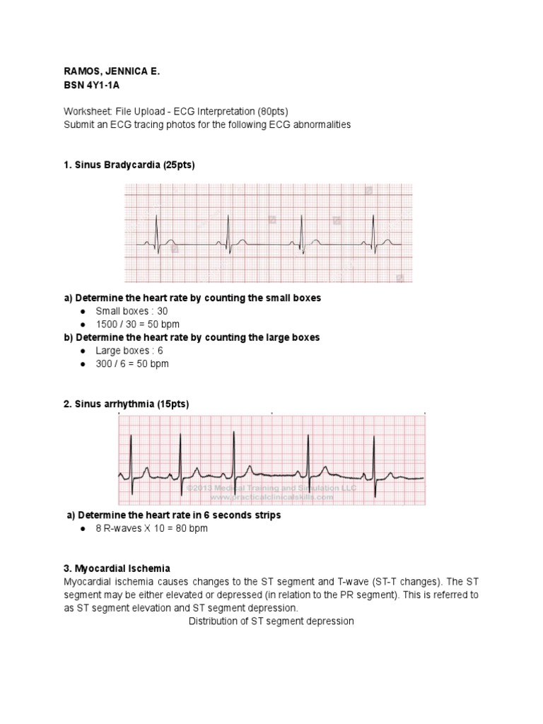 ECG Interpretation | PDF | Electrocardiography | Physiology