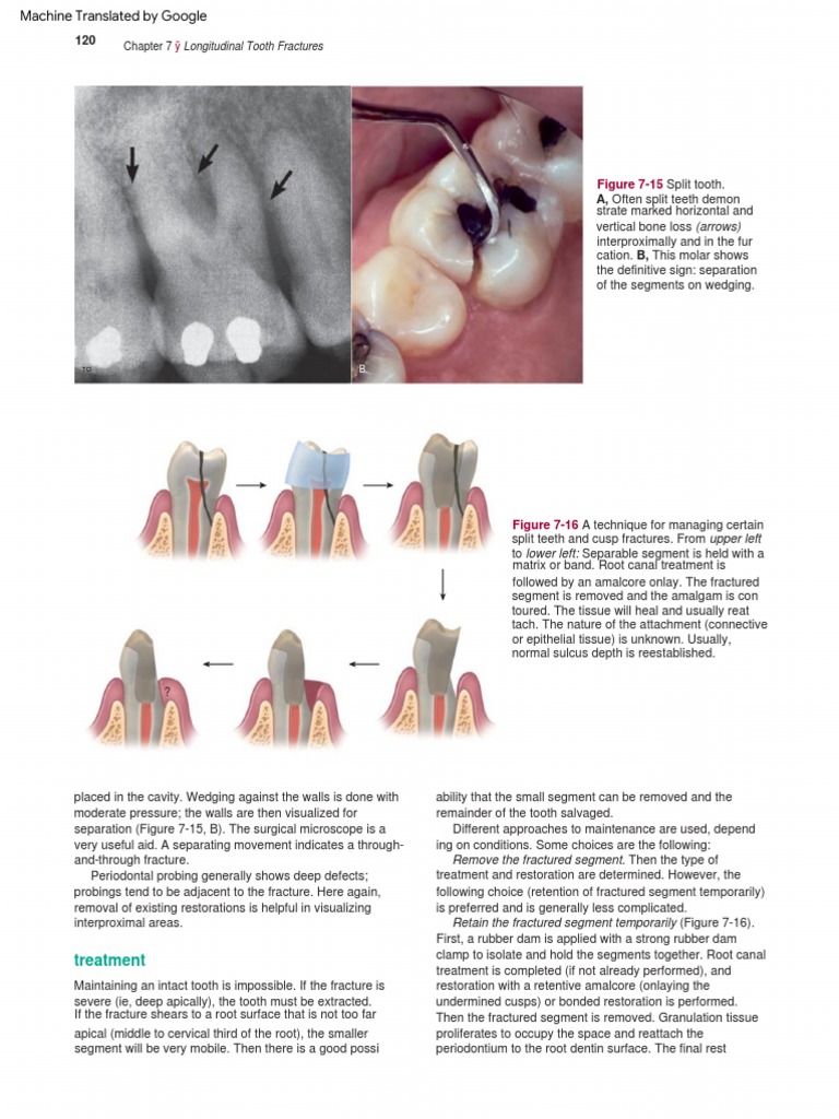 Endodontics Principles and Practice (139 279) | PDF | Tooth | Dental Anatomy